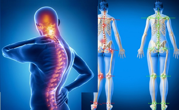 Happy Spine, Постурологичен анализ